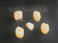 China Full Contour Porcelain Zirconia Ziconia for Crowns Bridges High Translucency for sale