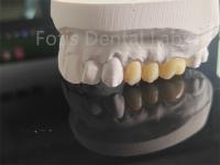 China High Strength Full Porcelain Layered Zirconia for Dental Crowns 900-1200 MPa for sale