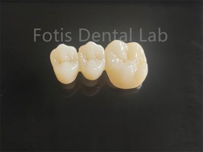 China High Strength Porcelain Layered Zirconia 900-1200 MPa for Durable Dental Bridges for sale