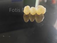China Zirconia Full Porcelain Dental Crown Bridge High Strength 16 Shade Aesthetic for sale