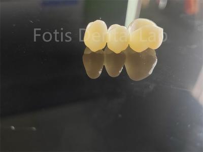 China Zirconia Full Porcelain Dental Crown Bridge High Strength 16 Shade Aesthetic for sale