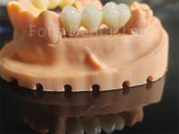 China Zirconia Layered Porcelain Dental Crown Bridge 1200 MPa Flexural Strength for sale