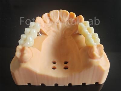 China Customized Full Contour Zirconia Layered Porcelain Dental Crown Bridge 900-1200 MPa for sale
