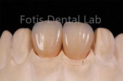 China High Translucency Multi Layer Zirconia Block for Dental Restoration Fabrication 98mm for sale