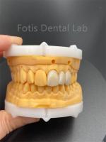 China Multilayered Zirconia Dental Ceramics 16-Layer Gradient for Dental Lab Prosthetics for sale