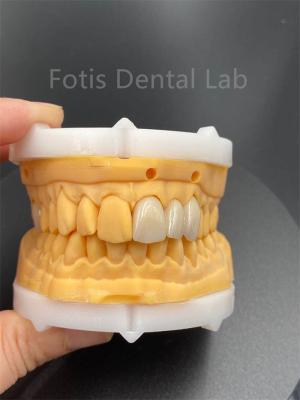 China Multilayered Zirconia Dental Ceramics 16-Layer Gradient for Dental Lab Prosthetics for sale