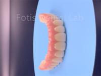 China High Strength Zirconia Multilayer Product For Superior Performance for sale