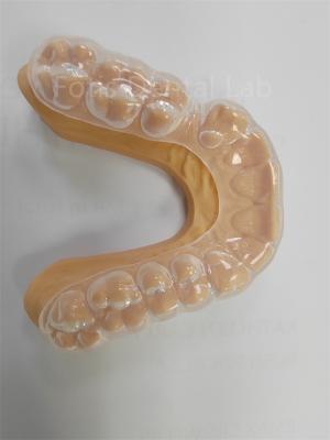 China Customizable Dental Hard Soft Night Guard for Bruxism Protection 2mm 5mm Thickness for sale