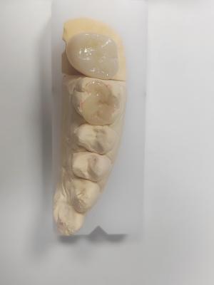 China Dental Ceramic Inlay and Porcelain Onlay for Indirect Tooth Restoration 2mm for sale