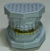 China China Dental Lab Lingual Wire Retainer For Teeth Expansion for sale
