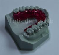 China Orthodontic Retainer Expander Adjustable Customizable FDA ISO Certified for sale