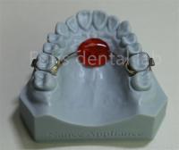 China Orthodontic Palatal Expander Retainer Adjustable One Size Fits All for Teeth Expansion for sale