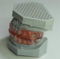 China Orthodontic Retainer Expander One Size Fits All Easy Clean Maintain for sale