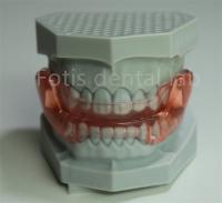 China Orthodontic Retainer Expander One Size Fits All Adjustable Customizable for Teeth Retention and Expansion for sale