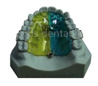 China Adjustable Orthodontic Retainer Expander One Size Fits All FDA ISO Certified China Dental Lab for sale
