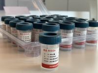 China TCT PAP Staining Reagent Kit 10ml/Bottle with Cell Preservation Solution for sale