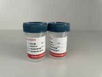 China Cytology Assay Reagent TCT Detection Kit With All Optional Consumables for sale