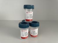 China TCT Detection Immunocytological Staining Kit For Cervical Cancer Screening for sale