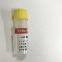 China KISSH Primary Antibody Products Ki-67 Immunoassay Antibody Test IHC 1.5mL 3.0mL for sale