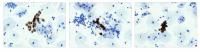 China Cervical Cancer Screening ICC Immunoassay Test Kit Staining Keypath P16 for sale