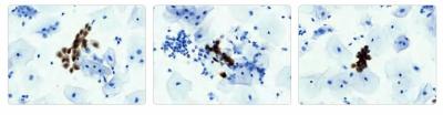China Cervical Cancer Screening ICC Immunoassay Test Kit Staining Keypath P16 for sale