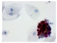 China Immunoassay Powerful Biomarkers IHC Staining Kit For Cervical Cancer Screening for sale