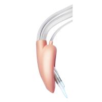 China Size 3 Disposable Anesthetic Laryngeal Mask , PVC LMA Supraglottic Airway Devices for sale