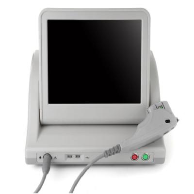 China Hifu Face Lift Machine Portable for sale