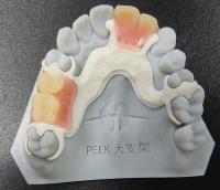 China Customizable Peek Removable Denture Partial Framework Wear Resistance for sale