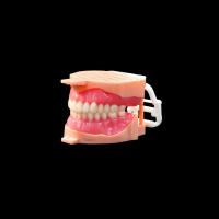 China Digital Complete Removable Denture Removable Partial Prosthodontics for sale