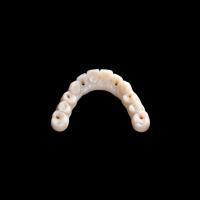 China All On X-Zirconia Bridge for sale
