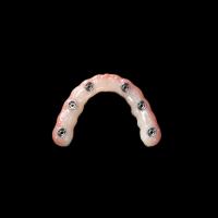 China ALL On  X Implant Zirconia Bridge With Titanium Base Zirconia Crown Bridge for sale