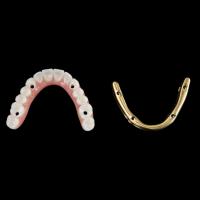 China Customize Hybrid Dental Implants Hybrid Denture With Titanium Bar for sale