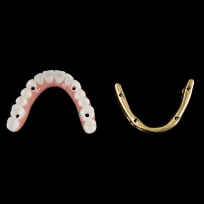 China Customize Hybrid Dental Implants Hybrid Denture With Titanium Bar for sale