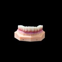China ALL On  X Implant Titanium Bridge Dental With Composite Accurate for sale