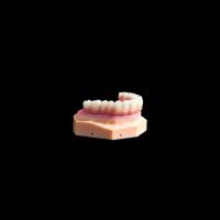 China Ti Base Crown Implant Titanium Crown / Bridge Coping With Composite for sale