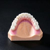 China ALL On  X Implant Zirconia Bridge Implant Crown Bridge Natural Appearance for sale