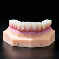 China ALL On  X Implant Zirconia Bridge Implant Crown Bridge Natural Appearance for sale