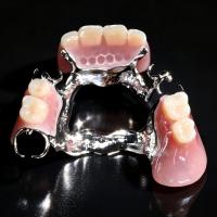 China Customizable Removable Dentures Titanium Framework Dental Metal Framework for sale