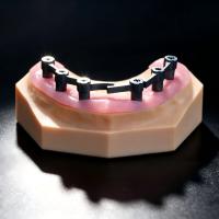 China External Connection Digital Scan Body Precise Scan Bodies For Dental Implants for sale
