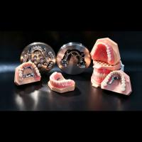 China Pink Removable Partial Acrylic Denture Temporary Acrylic Partial Denture for sale