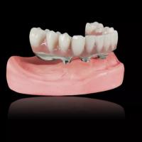 China Implant Titanium Bar Removable Dentures Titanium Alloy Implant Bar Overdenture for sale