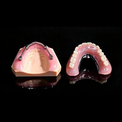 China All On X Implant Titanium Bar With Removable Denture for sale