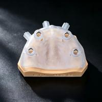 China Edentulous Implant Surgical Guide Ergonomic 3D Printed Surgical Guides for sale