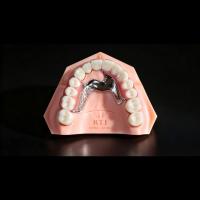 China High Strength Titanium Crown And Bridge Coping With Composite for sale