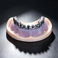 China All On X Implant Titanium Bridge for sale