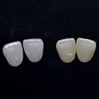 China Highly Aesthetic Zirconia Veneer Long Lasting Zirconia Emax Veneers for sale