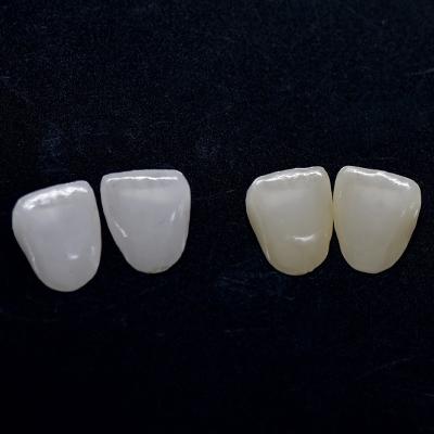 China Highly Aesthetic Zirconia Veneer Long Lasting Zirconia Emax Veneers for sale