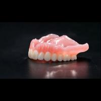China Full Arch Overdenture Removable Prosthodontics for sale