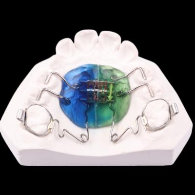China FDA Pendulum Appliance Orthodontics Pendulum Ortho Appliance Customizable for sale